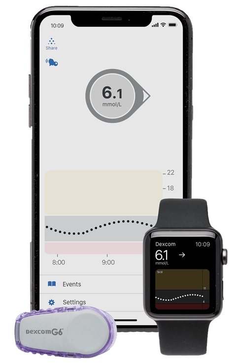 Switch to Dexcom G6